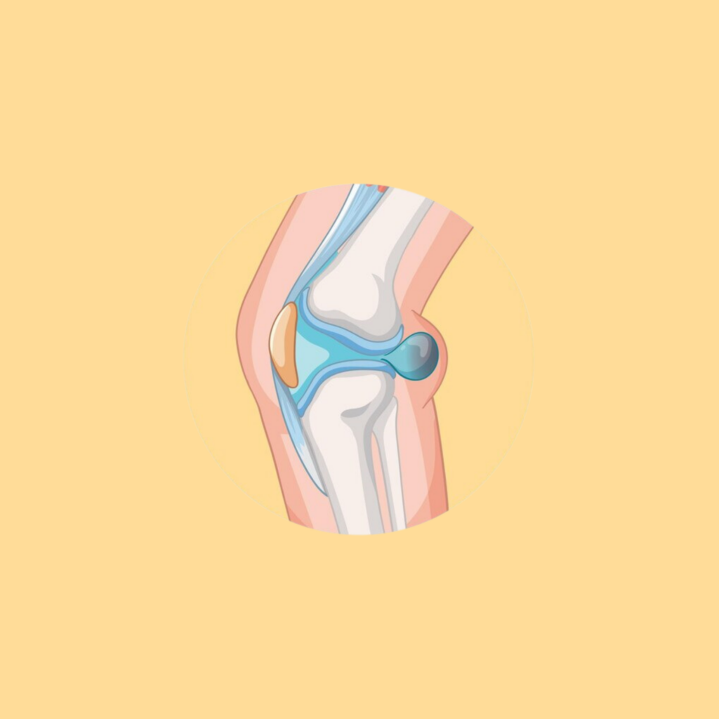 Fibromyalgi: Årsager, behandling og håndtering | Smertefribevægelse